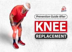 Tips to Prevent Complications After Knee Replacement Surgery